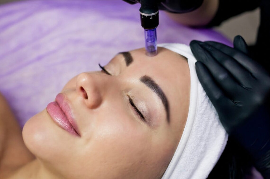 Bio Microneedling – Elite Body Contour & Drip Bar